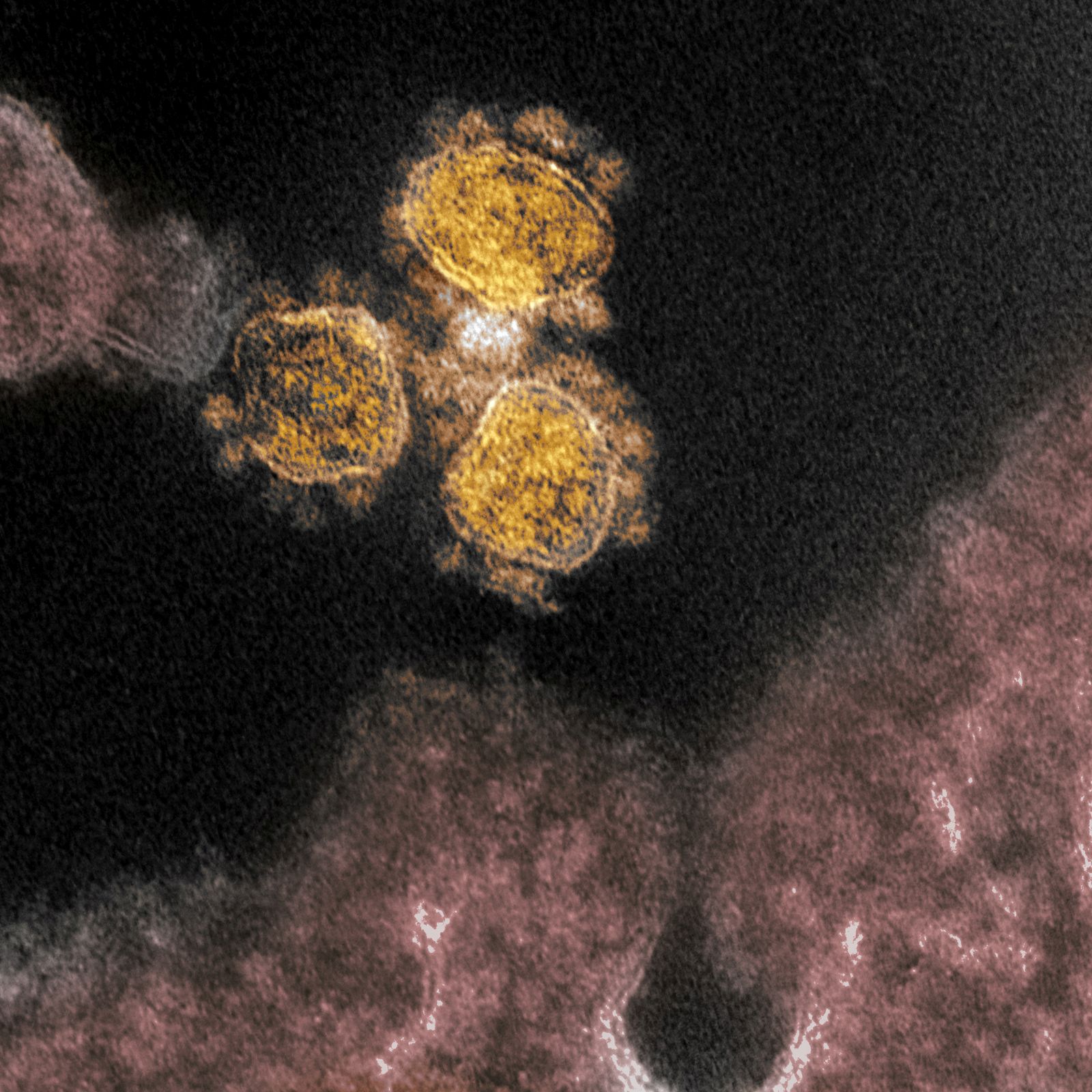 Electron micrographic images of SARS-CoV-2 – Bifrost